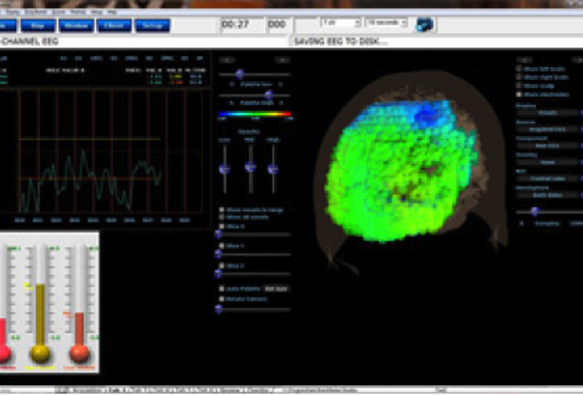 NEUROFEEDBACK – Unique Therapy